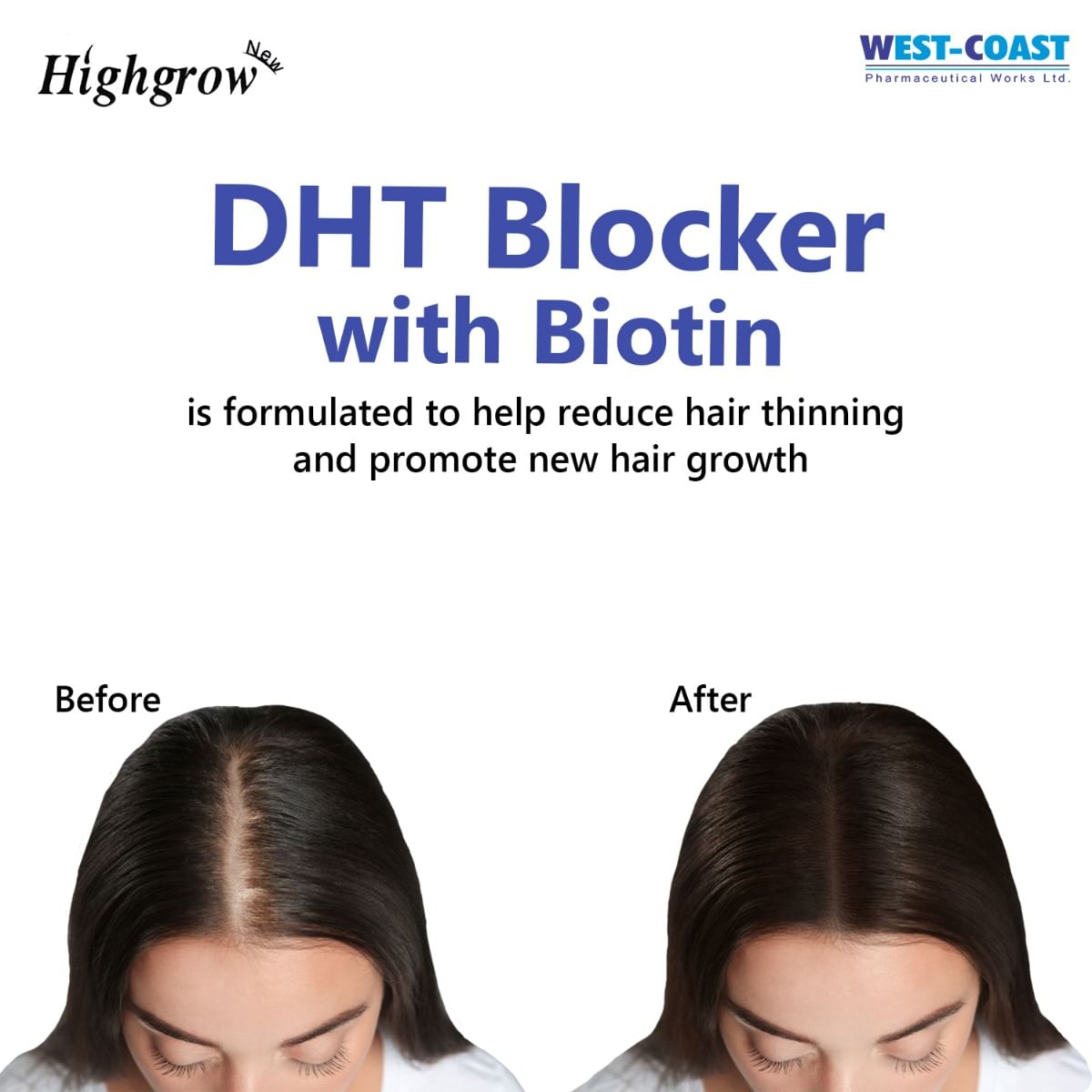 Westcoast Highgrow Tablet for Hair Growth & scalp health with Biotin ...