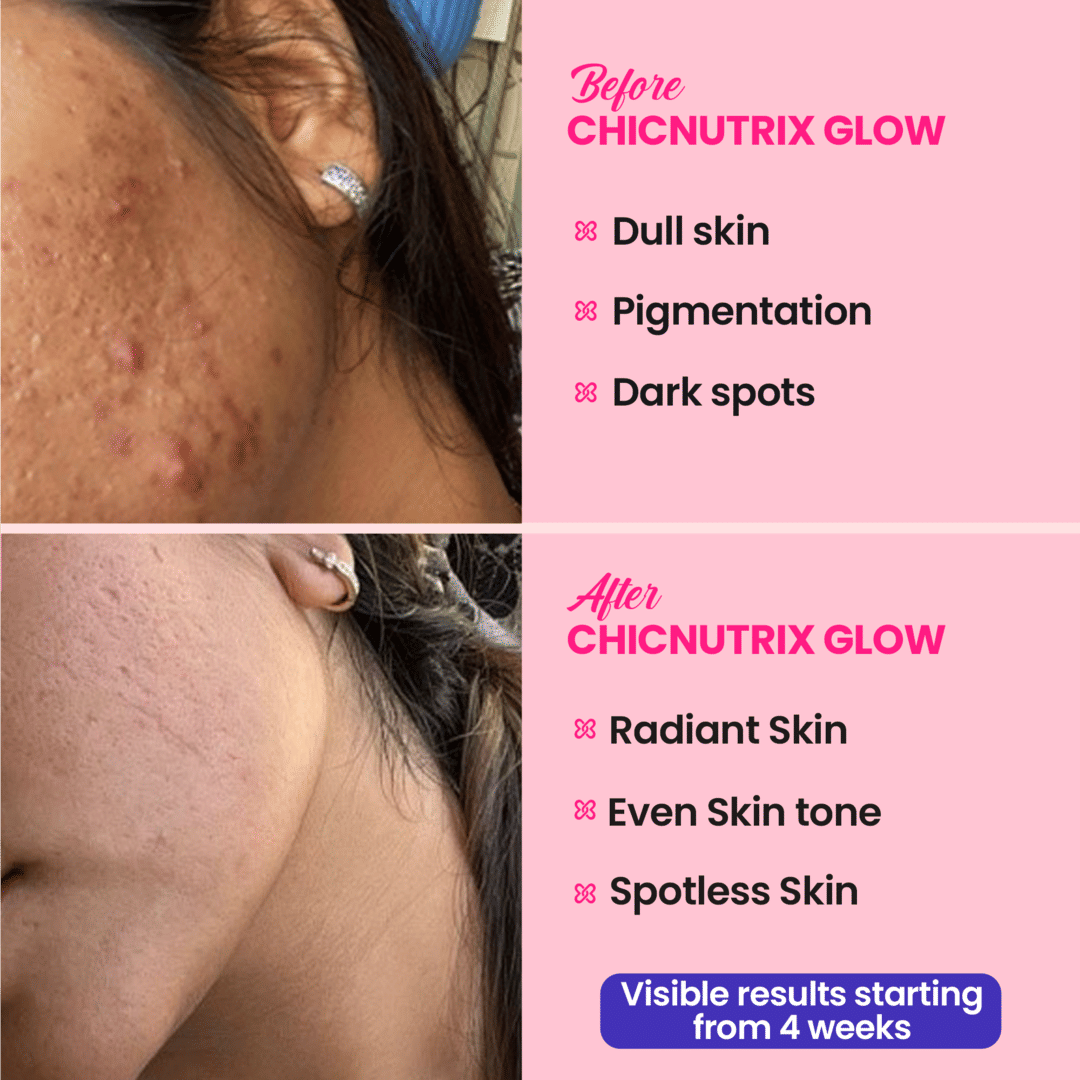 Chicnutrix Glow Effervescent Glutathione Tablets for Glowing Skin | 20 ...